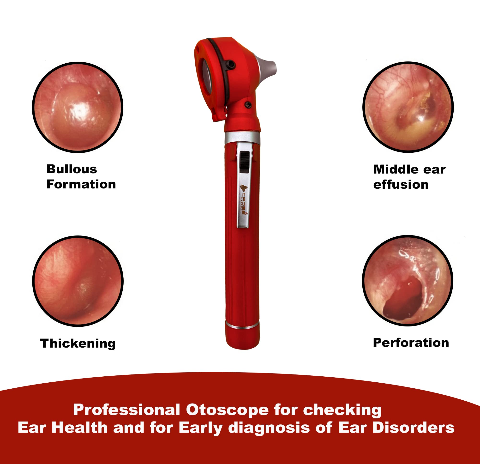 Cross Canada 11-082 Physician Fiber Optic LED Pocket Otoscope Diagnostic Set - Red
