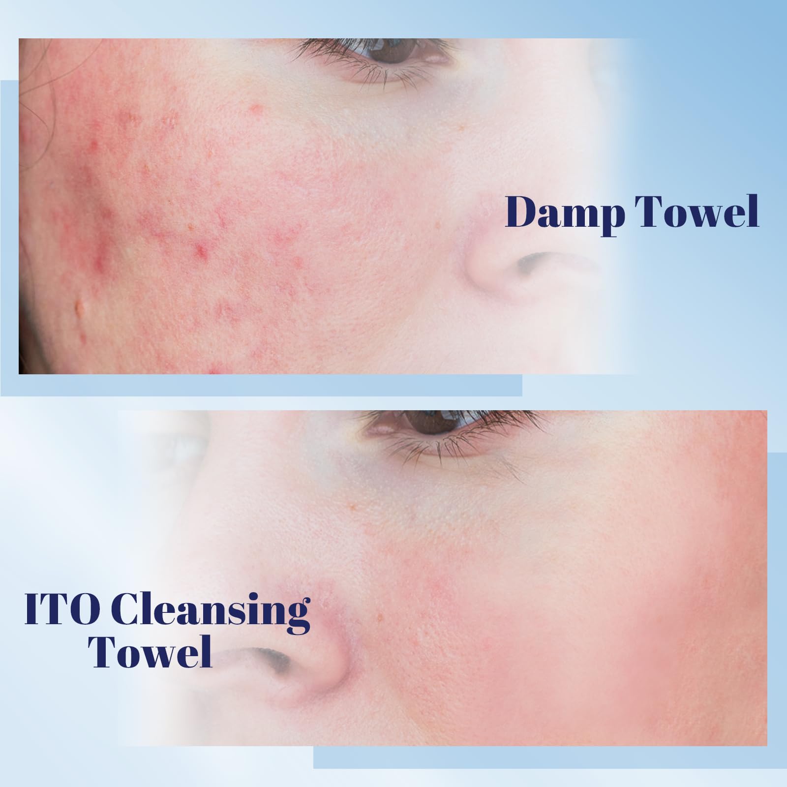 ITO Disposable Face Towel, 70 Count Ultra-Soft 1-Second Quick-Dry Face Towels, Gentle for Sensitive Dry Oily Skin, Facial Towels for Daily Cleansing Makeup Removal (1 Pack)