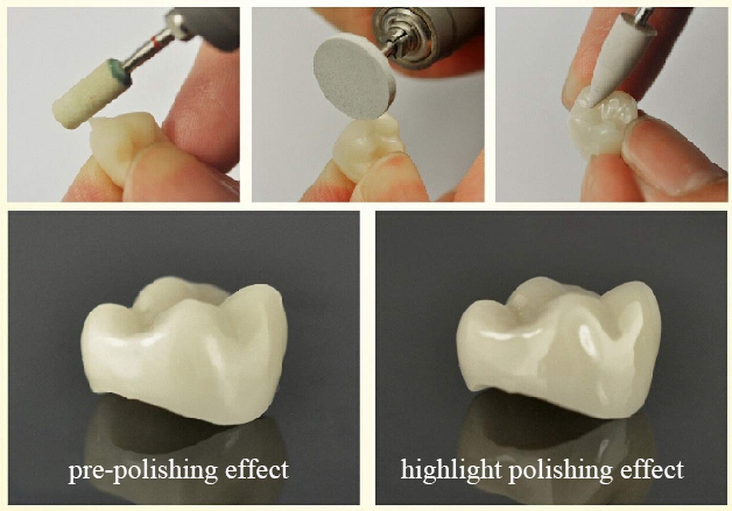 Supershu Polishing Kit For Composite
