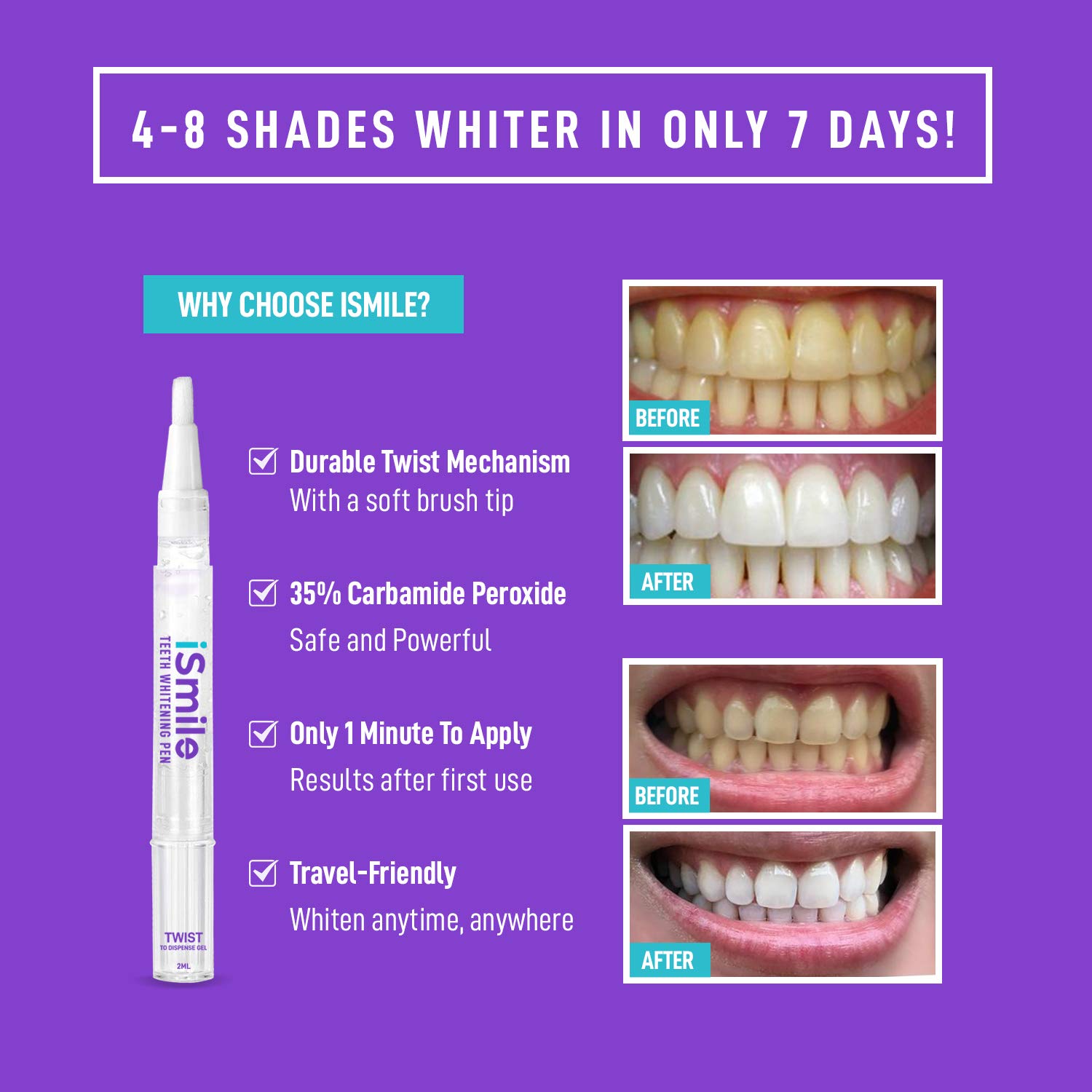 iSmile Teeth Whitening Pen - 35% Carbamide Peroxide, No Sensitivity, Travel-Friendly, Easy to Use, 2mL, 2 Pack