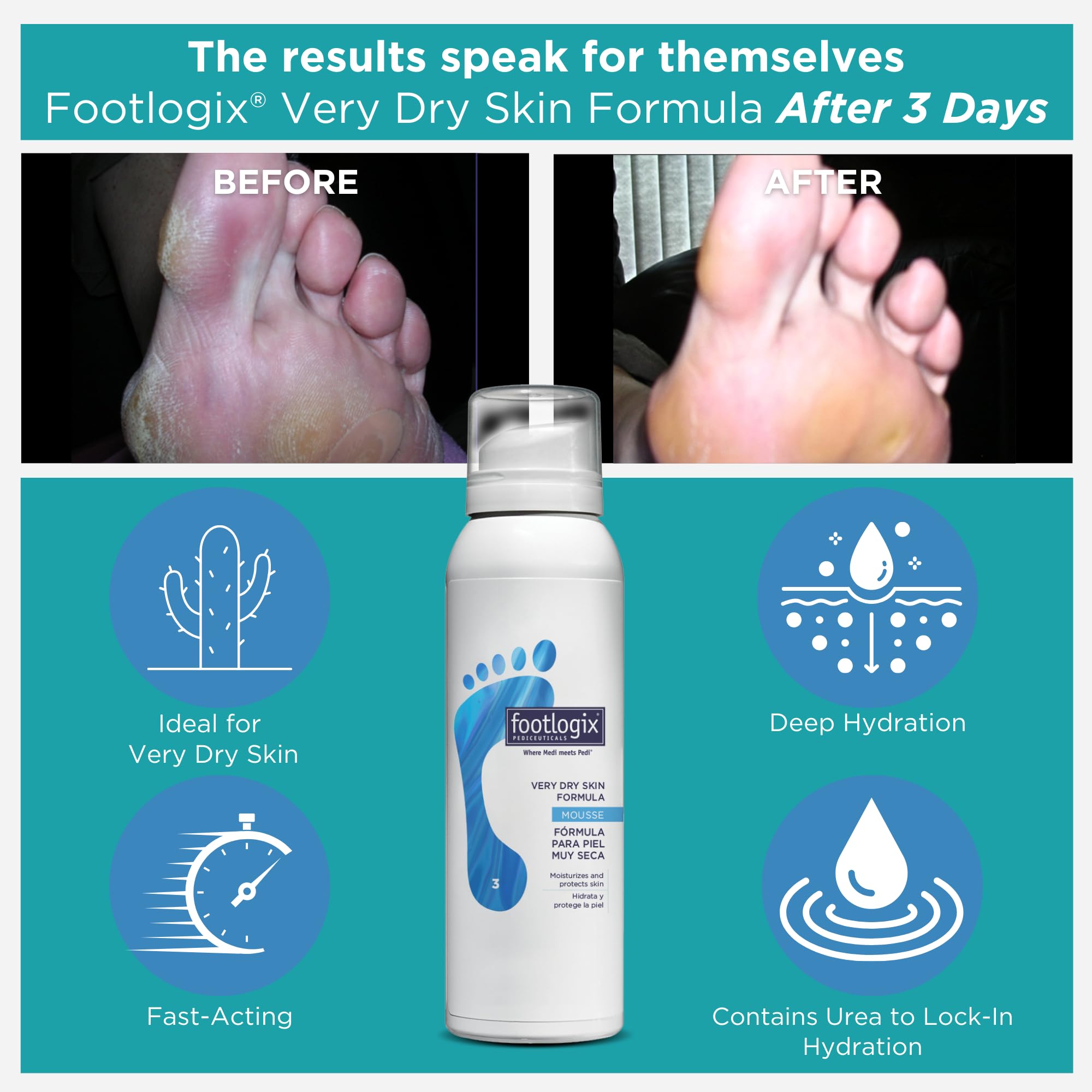 Footlogix Very Dry Skin Formula 3