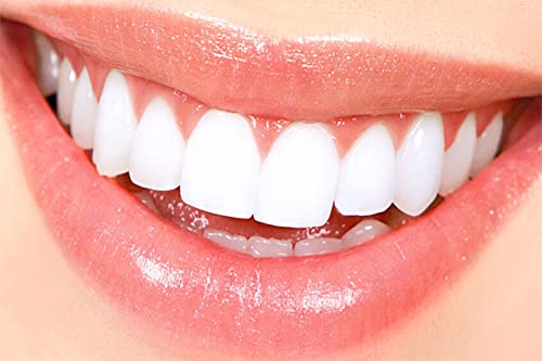 Finafta - Oral anesthetic Treatment for Canker sores and Mouth and Gum irritations