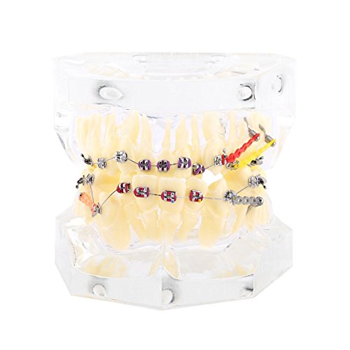 Teeth Educational Model Dental Treatment Malocclusion Study Demonstration Teeth Model with Wire Chain Orange