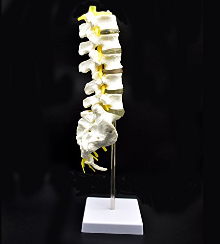 Medical Human Lumbar Spine Demonstration Model Anatomical Model Lumbar Vertebrae Sacrum & Coccyx, with Herniation Disc,for Science Classroom Study Display Teaching Medical Model 15 Inch Hight