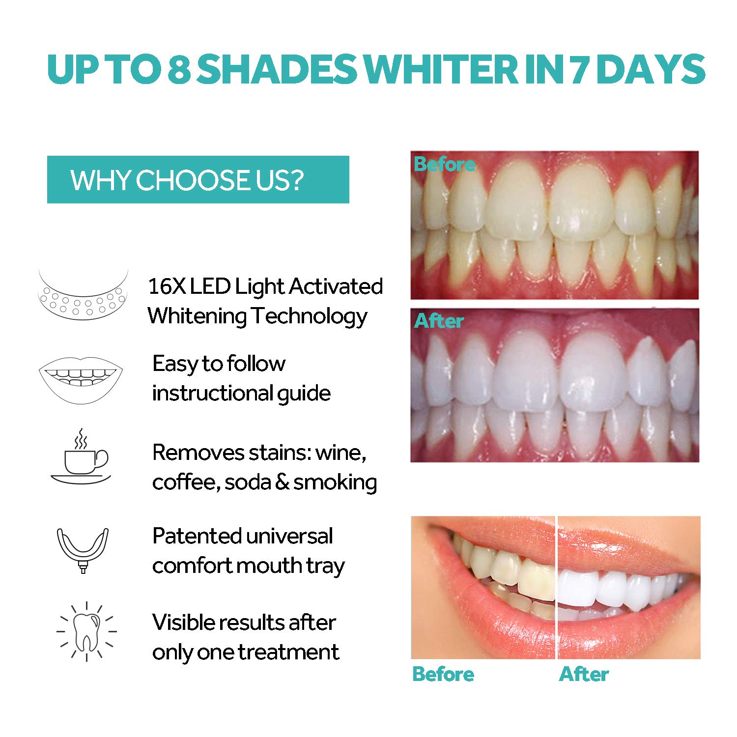 Teeth Whitening Light, PHOEBE New Upgrade 16 LED Teeth Whitening Accelerator Light Mouth Tray Teeth Whitening Enhancer Light Trays Connected with iPhone/Android/Type-C for Home Use