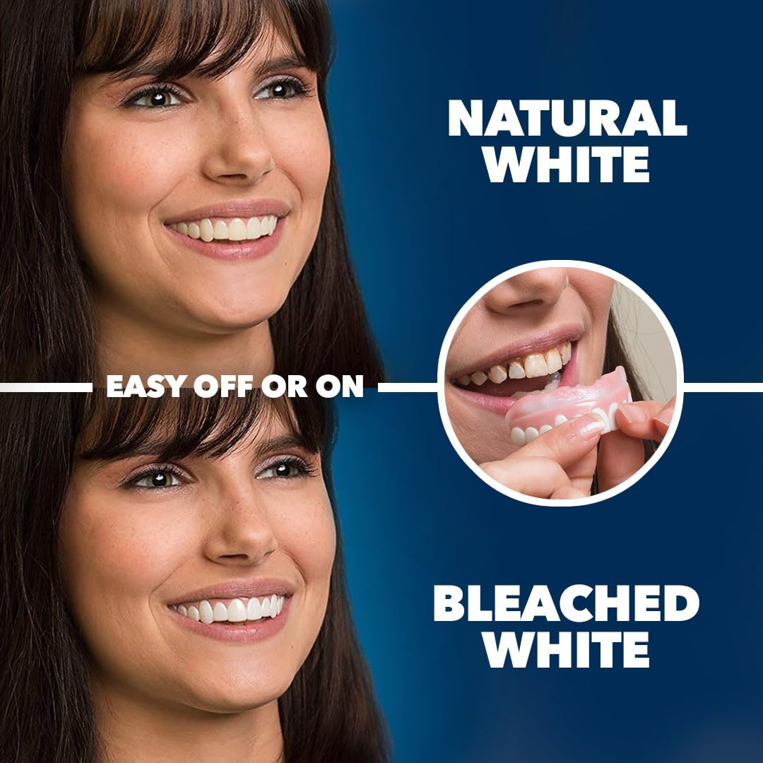 Imako Premium Cosmetic Teeth - 1 Pack - Large, Natural White - Upper Veneers - Custom Fit at Home, DIY Smile Makeover - Made in USA