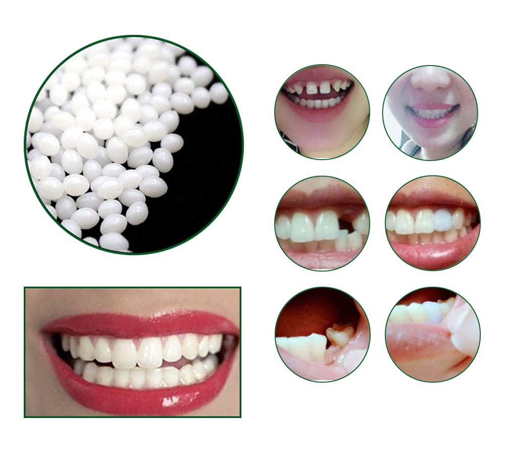 Multi-functional Temporary Tooth Repair Kit Moldable Thermal Fitting Beads for Snap On Instant and Confident Smile Denture Adhesive Fake Teeth Cosmetic Braces Veneer