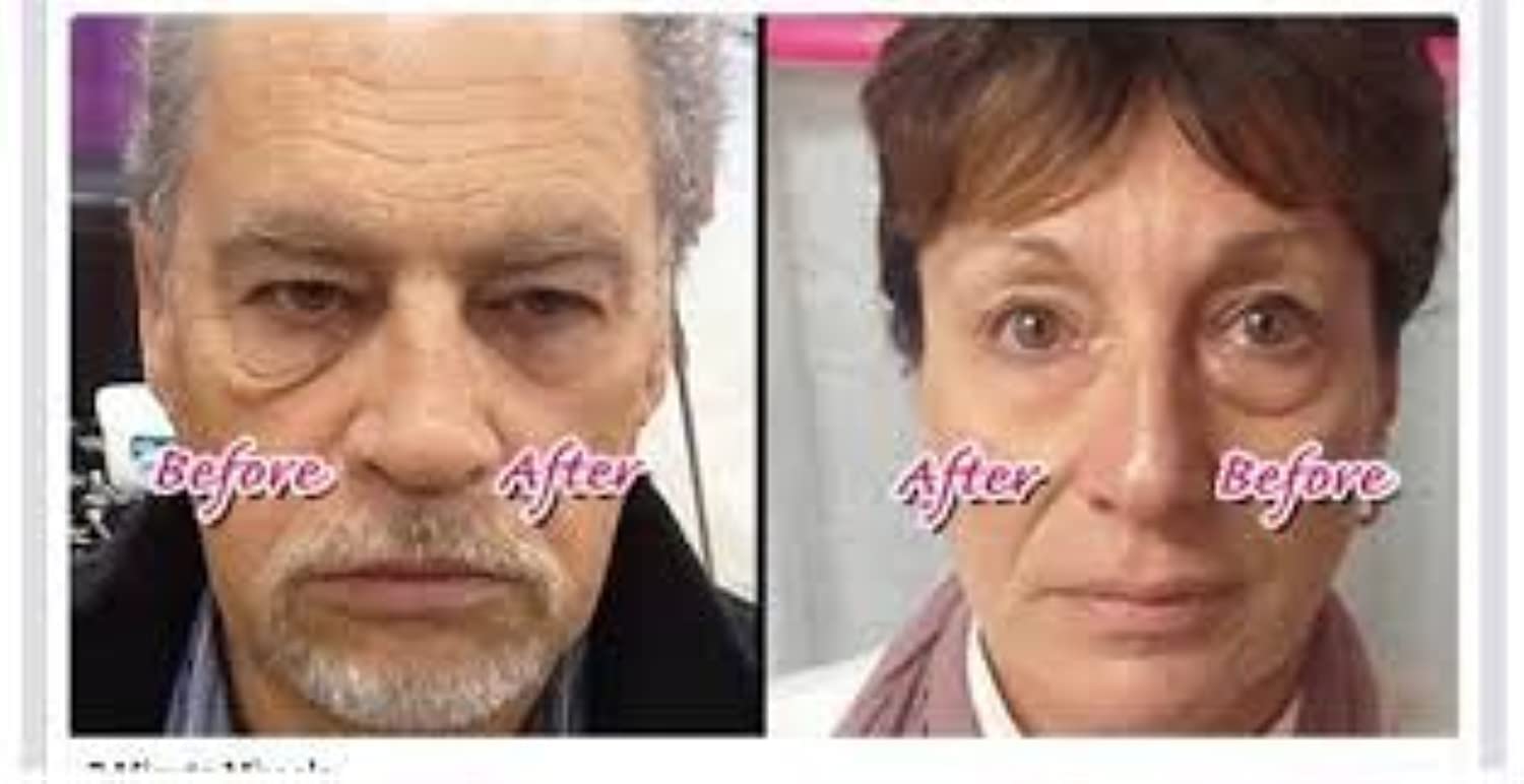 Instanly Ageless - Anti Wrinkle 5 Vials (.6mL Each)