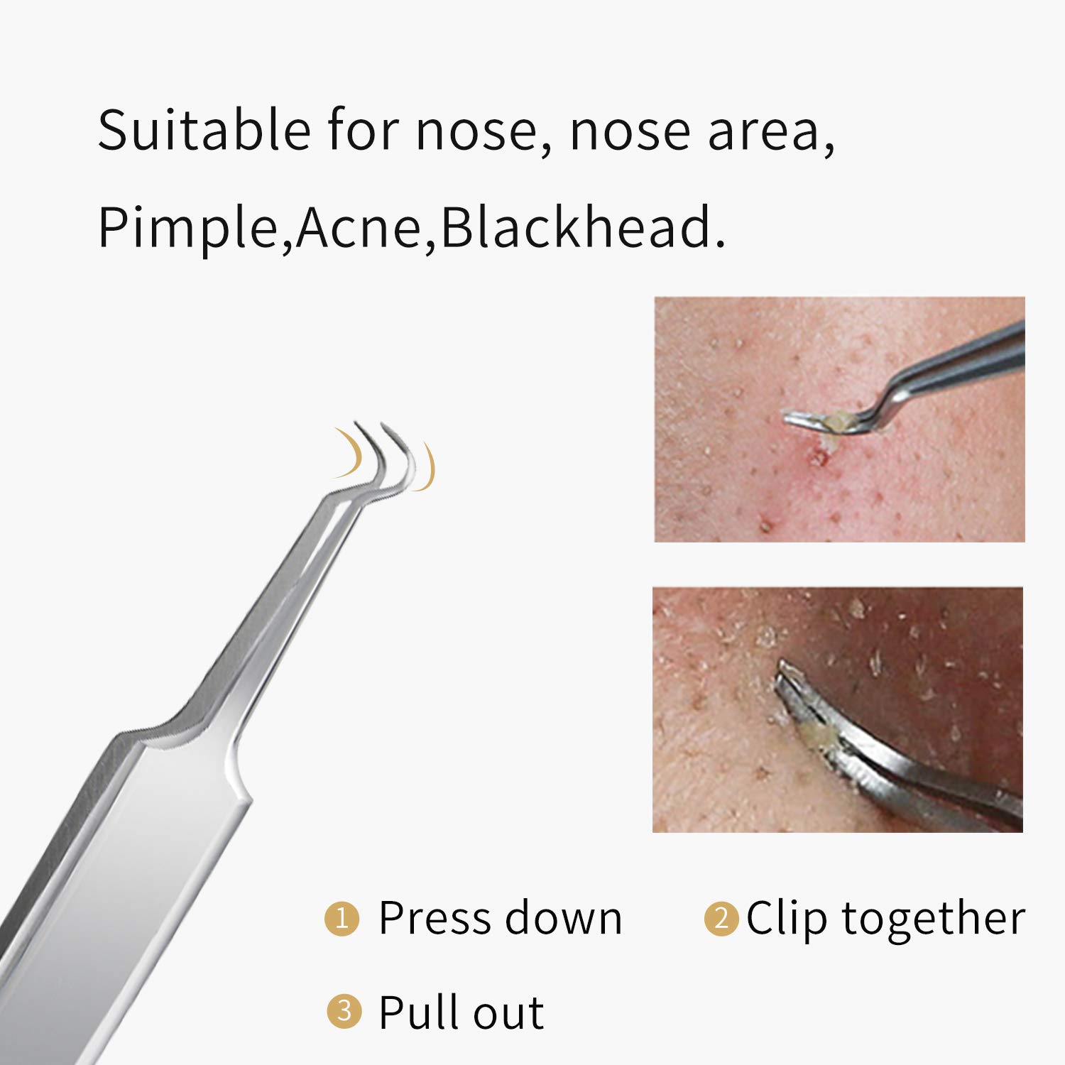 FIXBODY Blackhead and Splinter Remover Tools - Stainless Steel Professional Easily Cure Pimples Whiteheads Comedones Acne Zit Ingrown Hairs and Facial Impurities Bend Head Tweezer Surgical Kit