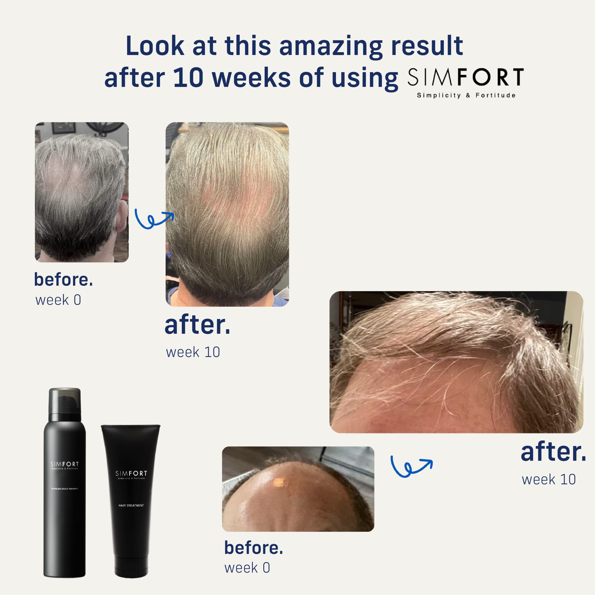 SIMFORT Carbonic Acid Shampoo 5.3oz & Conditioner 4.2oz Set for Men & Women, Fuller Thicker Stronger Hair Growth and Volumizing, Made with Natural Ingredients, NO Paraben/Sodium/Sulfate (Set of 1)