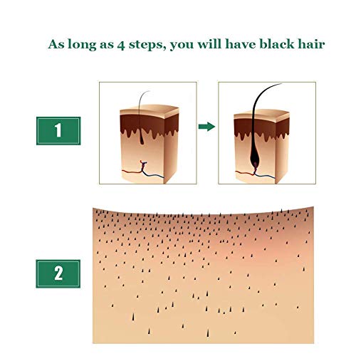 5 PACK Hair Growth Serum Liquid Hair Loss Treatment for Women & Men Dense Thicken Hair