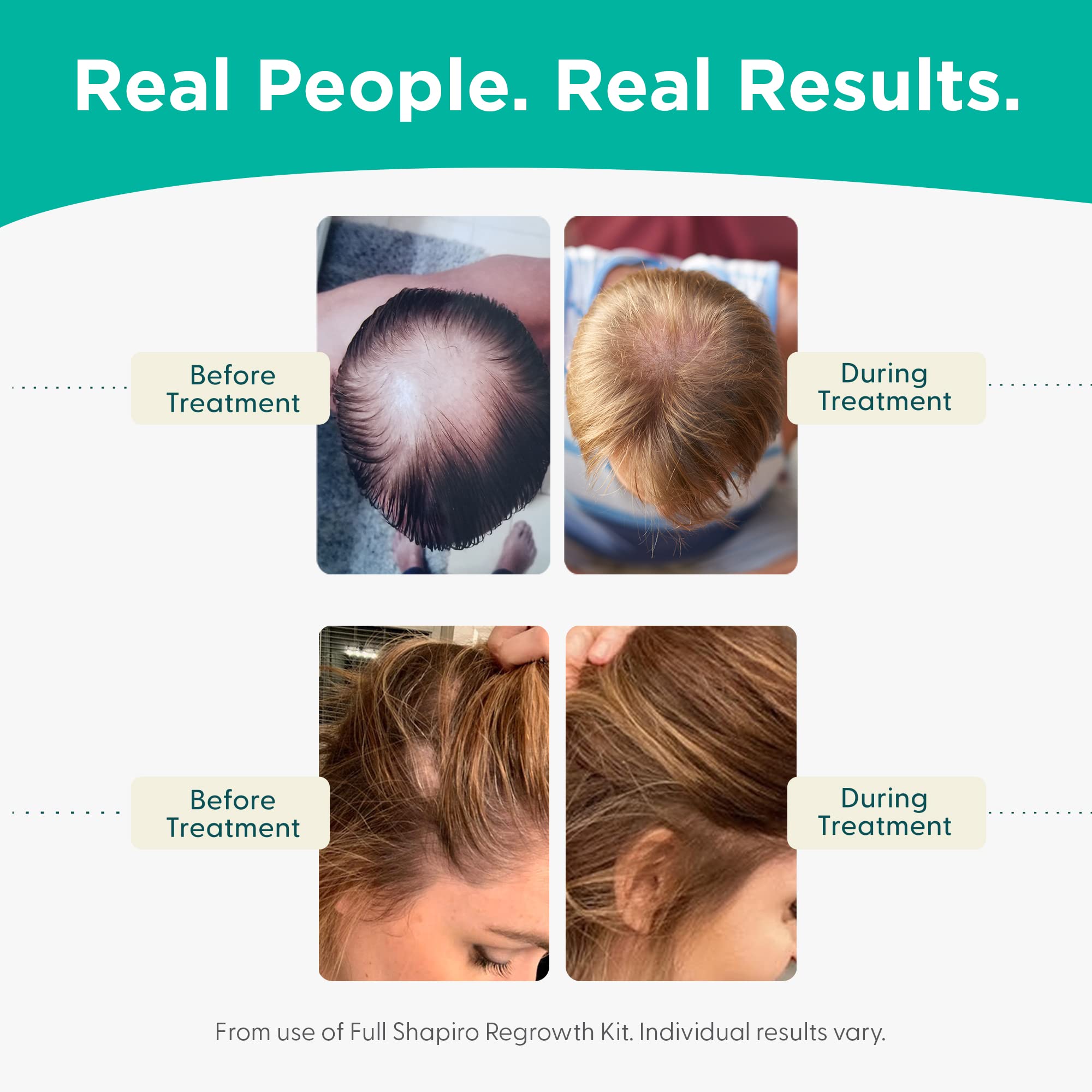 Hair Loss Conditioner | DHT Fighting Vegan Formula for Thinning Hair Developed by Dermatologists | Experience Healthier, Fuller and Thicker Looking Hair - Shapiro MD | 1-Month Supply