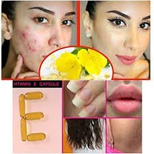 Merck Ltd. 50 Evion Capsules Vitamin E For Glowing Face,Strong Hair,Acne,Nails, Glowing Skin 400mg