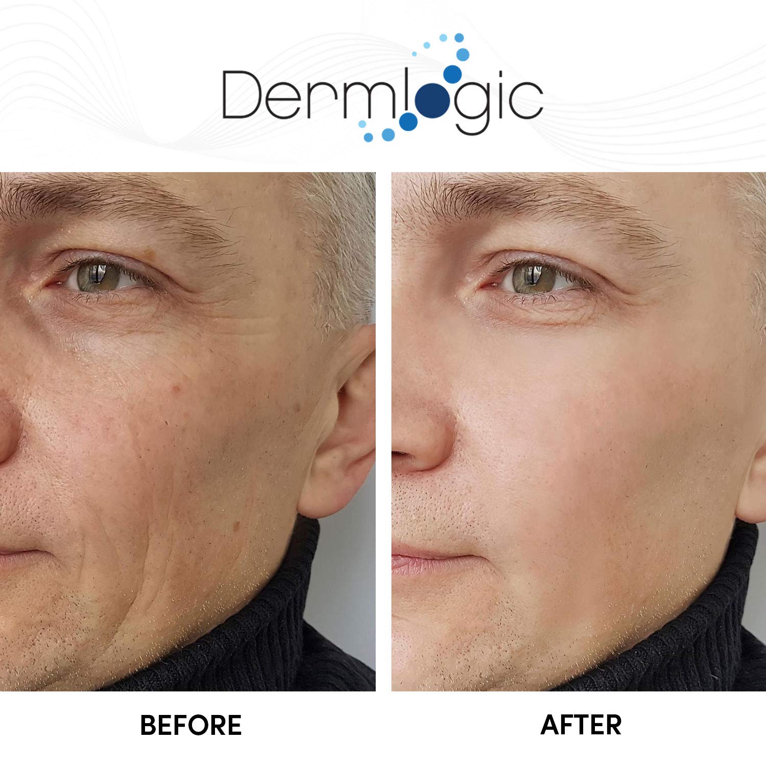 Glycolic Cream 15% - Natural Anti Aging Exfoliator to Smooth Away Fine Lines & Wrinkles & Improve a Dull Looking Complexion. Includes A.H.A & Green Tea Moisturizer for Face & Body.