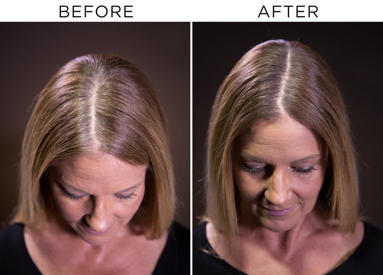 Hairatin Premium Root Touch Up | Cover Up Gray Hairs & Roots | Works Instantly & Water Resistant | Thicker Looking Hairlines Between Salon Trips | Root Concealer Without Salon Spray – Black