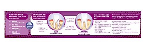 CAREDO Healing Periodontitis Treatment At Home Toothpaste, Periodontal Disease Treatment 3.52oz 2 Tubes, Gingivitis Treatment for Gum Disease, Fluoride Free Toothpaste for Bleeding Gums and LooseTeeth