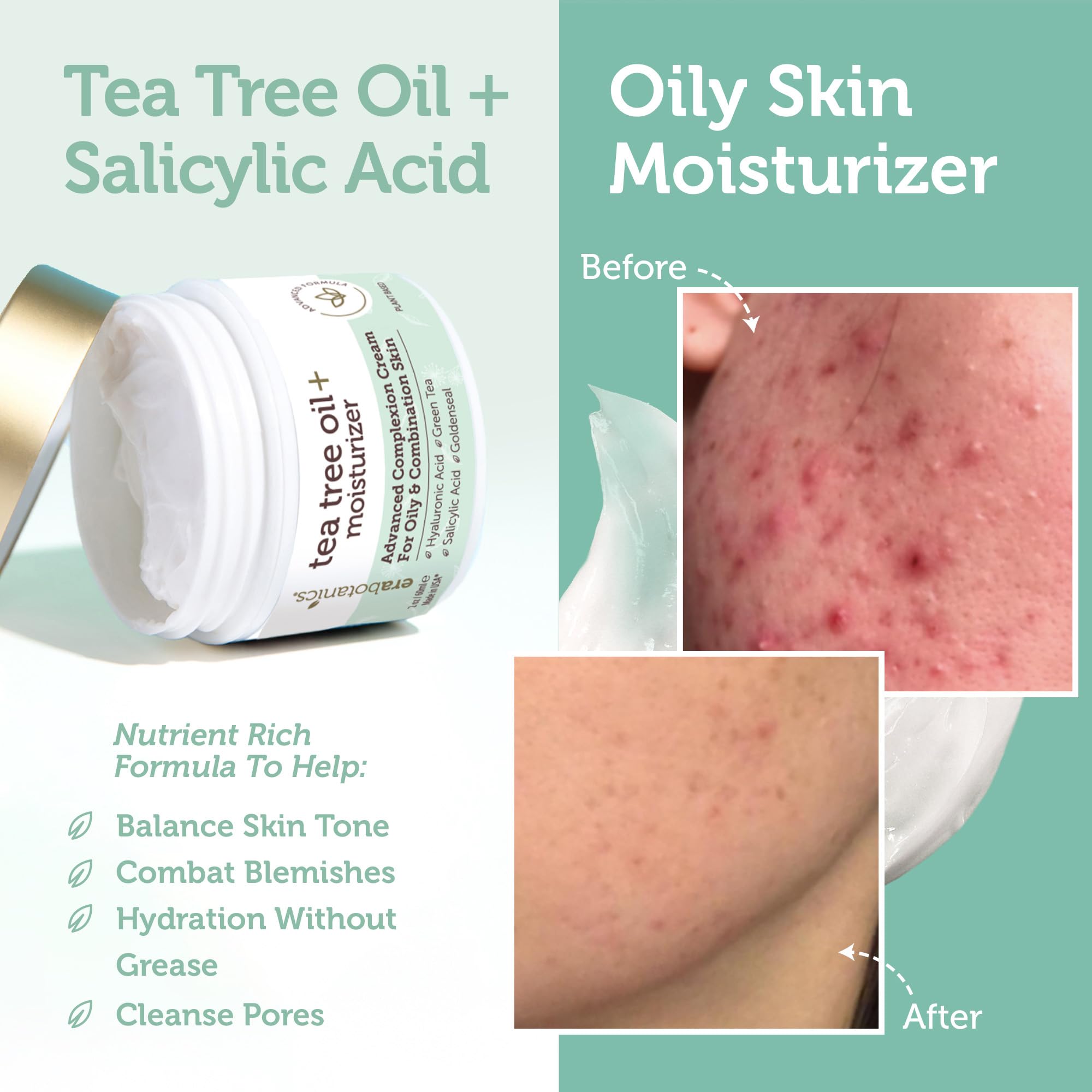 Era Organics Tea Tree Cream Face Moisturizer for Oily Skin - Advanced 7X Balancing Oily Skin Moisturizer - Non-Greasy Moisturizer - Tea Tree Oil for Skin