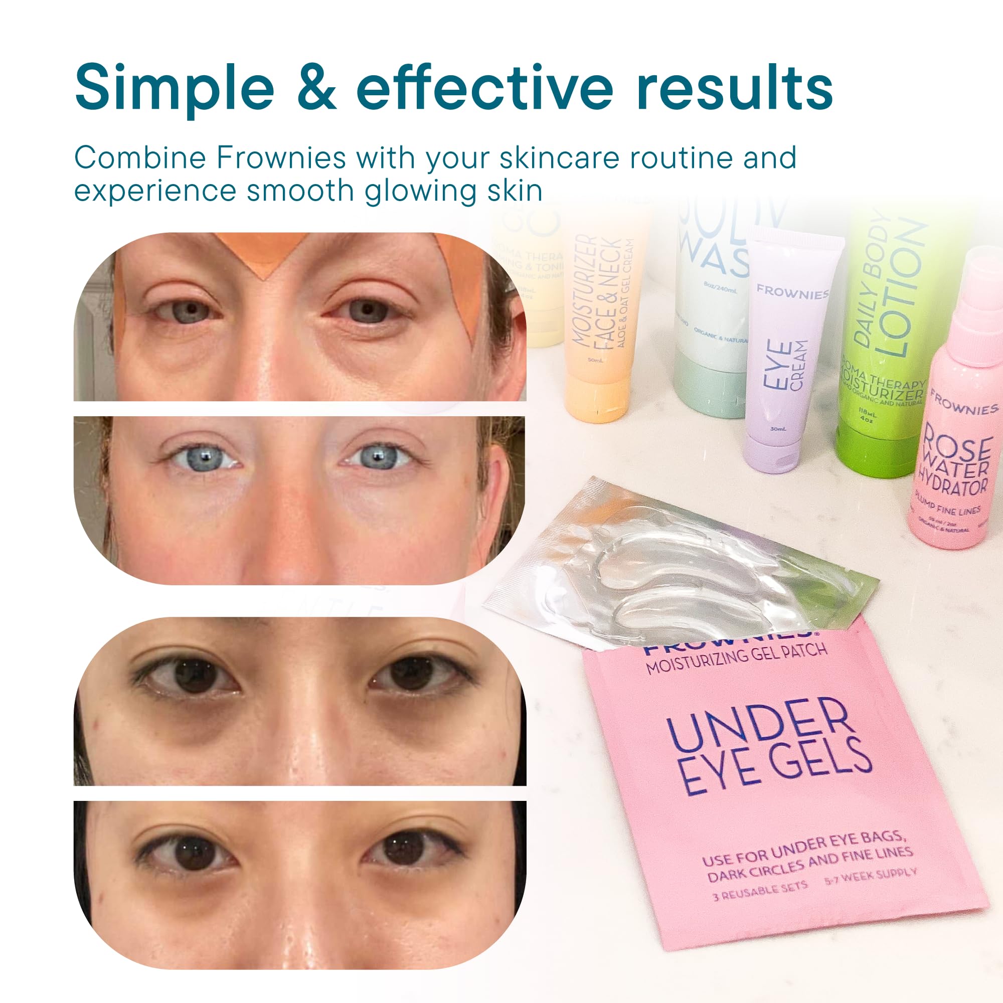 Frownies Under Eye Gel Patches for Puffy Eyes - Dark Circles with Cactus Collagen - Reusable, 3 Pack