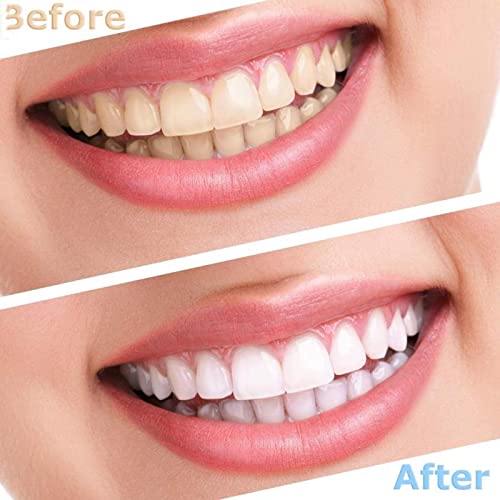 CHNLML,2 PCS Dentures Teeth - Temporary Teeth Perfect Fake Teeth - Veneers Dentures for Men and Women