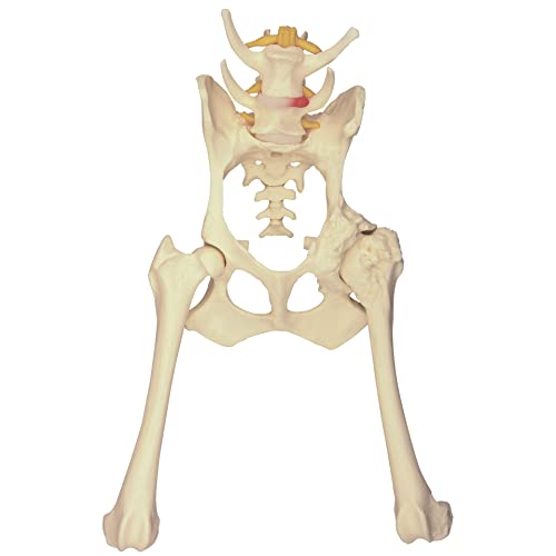 GPI Anatomicals - Canine Pelvis Model, Normal and Osteoarthritic Hip Joint Bones for Anatomy and Physiology Education, Anatomy Model for Veterinarianās Offices and Classrooms, Medical Study Supplies