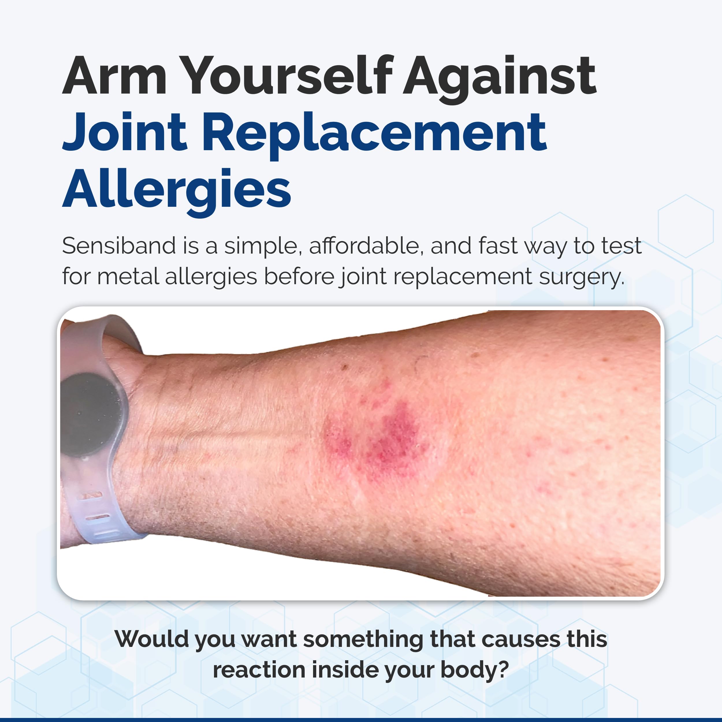 SENSIBAND Metal Allergy Test Band β Test at Home or Anywhere - Tests for Common Metals Used in Piercings & Jewelry - See Your Own Results - Order 3 Weeks Before Surgery.β¦ (Copper)