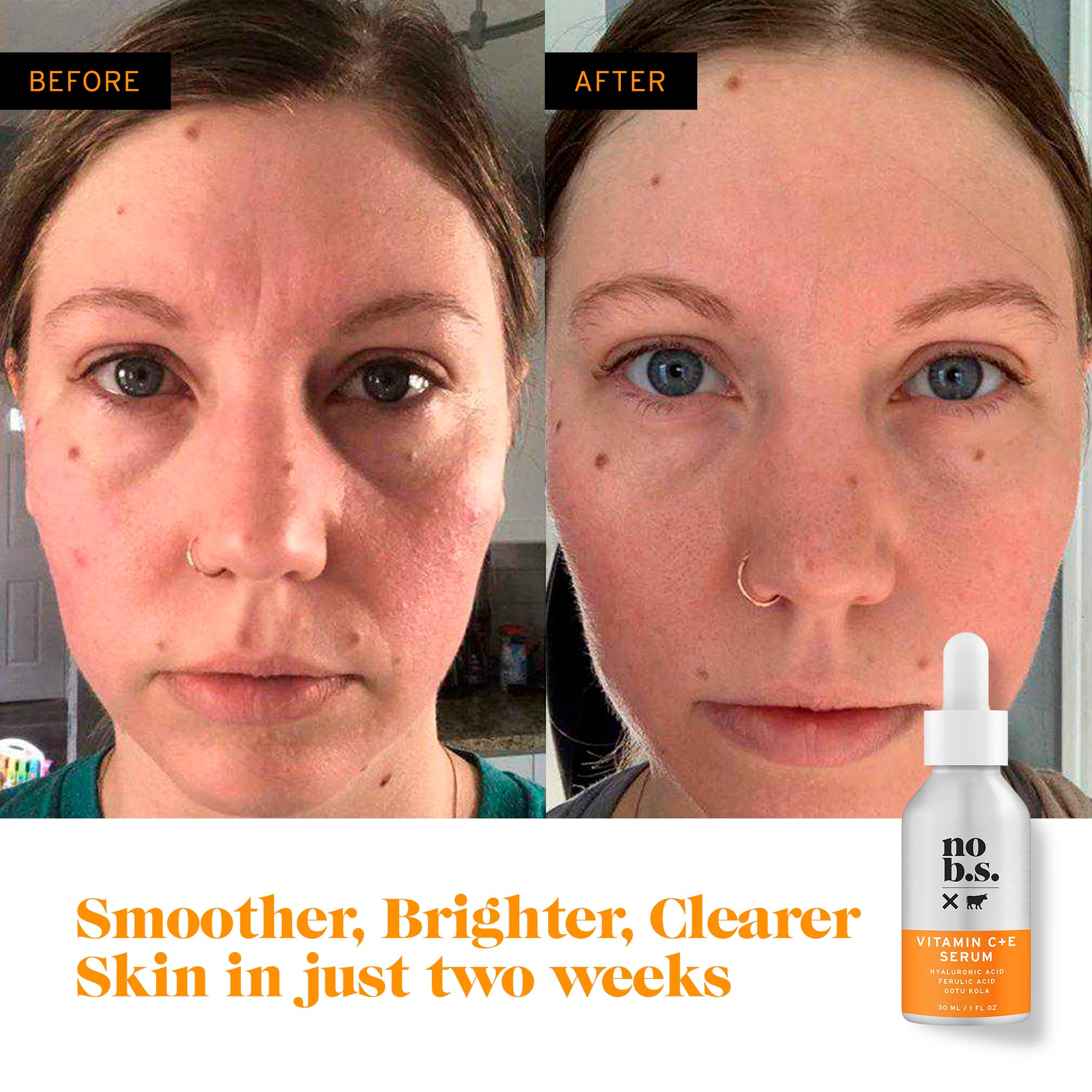 No B.S. (No Bad Stuff) Vitamin C + E Serum - Firming Face Serum for Anti-Aging, Smooths, Hydrates, Plumps Fine Lines & Reduces Dark Spots (1 fl oz)