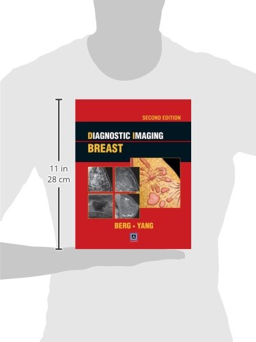 Diagnostic Imaging: Breast
