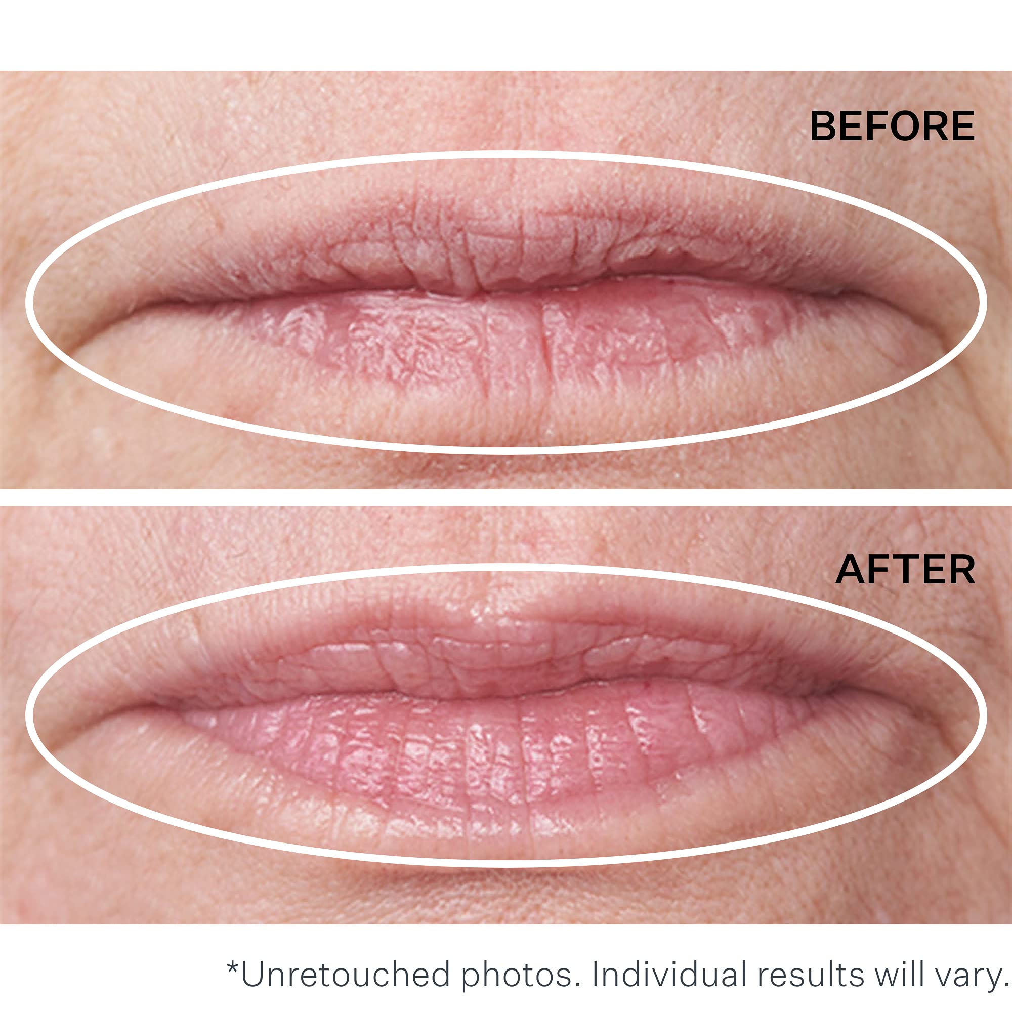 StriVectin Anti-Wrinkle Double Fix for Lips Plump and Smooth Vertical Lines, Hydrating Two-in-One Treatment, 0.16 Fl O