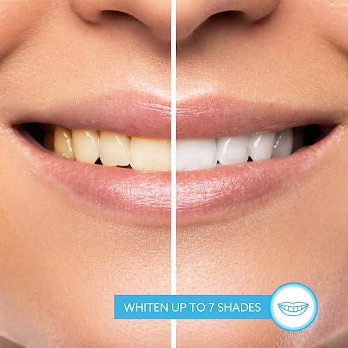GO SMILE Sonic BLU Hands-Free Professional Teeth Whitening Kit - Hands Free Toothbrush With Gum Massager - Includes Cordless Charger & Foaming Toothpaste & Whitening Tray - No Tooth Sensitivity -Black