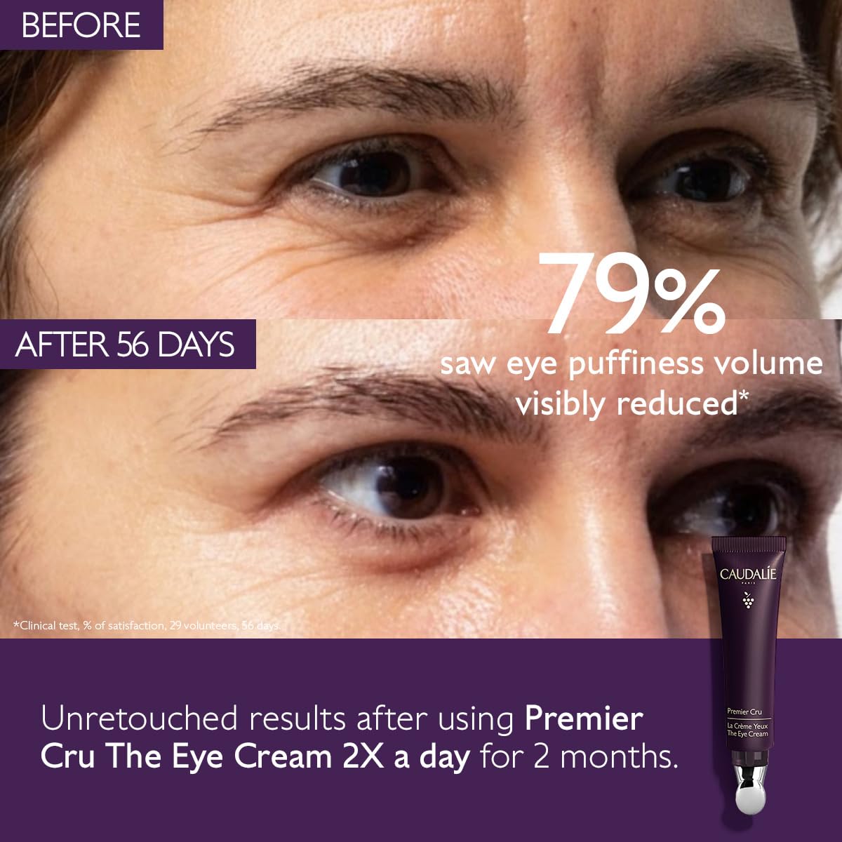Caudalie Premier Cru Anti-Aging Under Eye Cream - Targets Dark Circles, Fine Lines, and Deep Wrinkles - Firming, Plumping, and Hydrating, 15mL