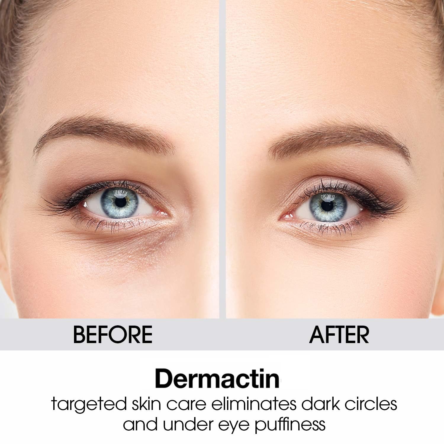 Dermactin Upper Eyelid Cream 1 oz. Firms & Tones Sagging & Drooping Skin On Upper Eye Lids, for Younger, More Vibrant & Alert Appearance, for Sensitive Skin In The Eyelids
