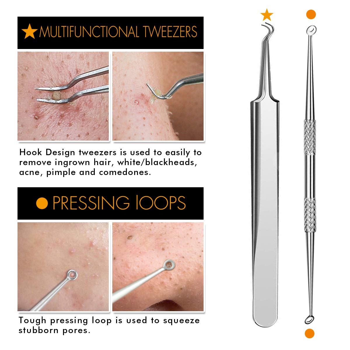 7-Piece Blackhead Remover Kit - Pimple Comedone Extractor Tool set for Facial Acne and Treatment for Blemish, Whitehead Popping, Zit Removing for Risk Free Nose Face Skin with Metal Case