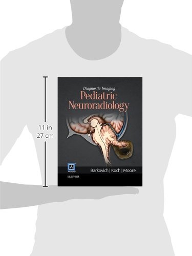 Diagnostic Imaging: Pediatric Neuroradiology