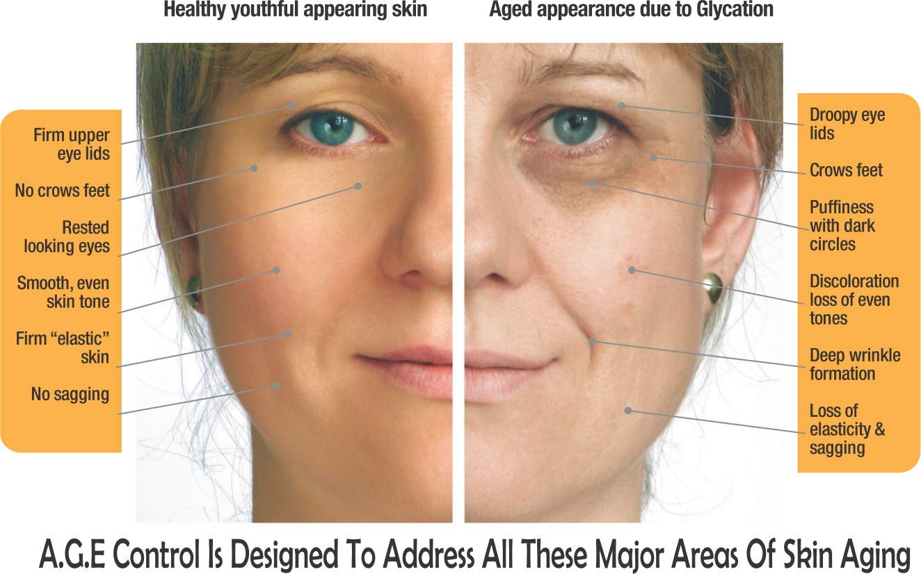 AGE Control Dual Treatment Anti Glycation Serum: Look 8-10 Years Younger In 60 Days. Reduce Discoloration & Dark Spots, Lifting, Firming, Brightening, Hydrating, Anti-Wrinkle, Non Greasy