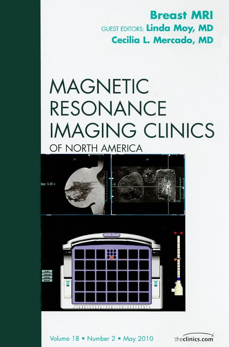 Breast MRI, Magnetic Resonance Imaging Clinics of North America, Volume 18, Number 2 (The Clinics: Breast MRI (The Clinics: Radiology, Volume 18-2)