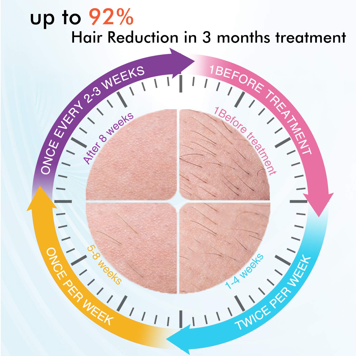 IMENE Permanent Hair Removal Machine for Women & Men, 500,000 Flashes IPL Hair Removal System with Ice Care Function for Full Body Home Use Hair Removal-Safest and Fastest IPL Technology