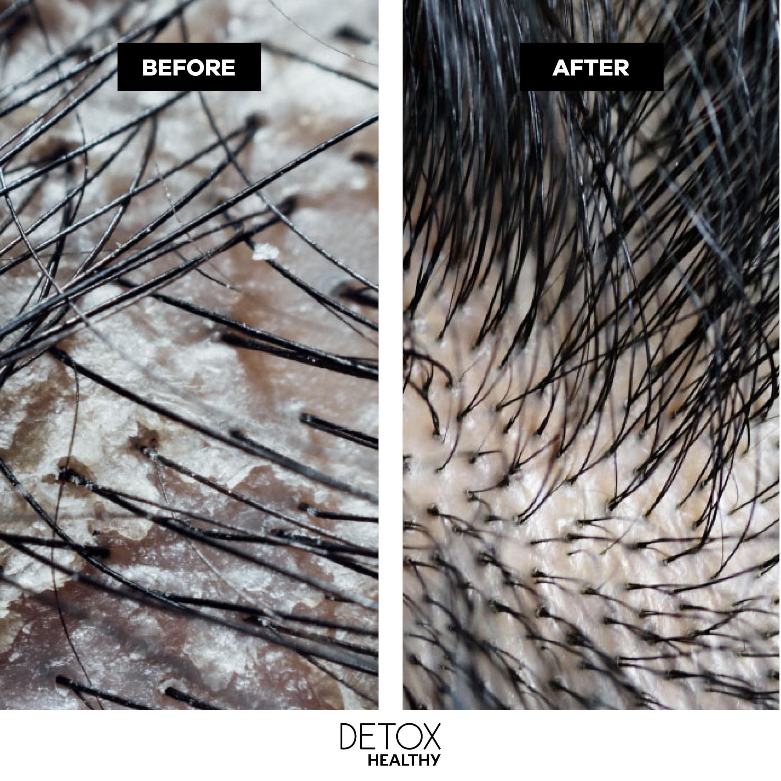 YBERA PARIS Professional Detox Healthy DUO | Refreshing Care for Oily | Prevent Hair Loss | Stimulate Growth & Improve Damaged Hair | Shampoo 8.4 Oz & Conditioner 8.8 Oz