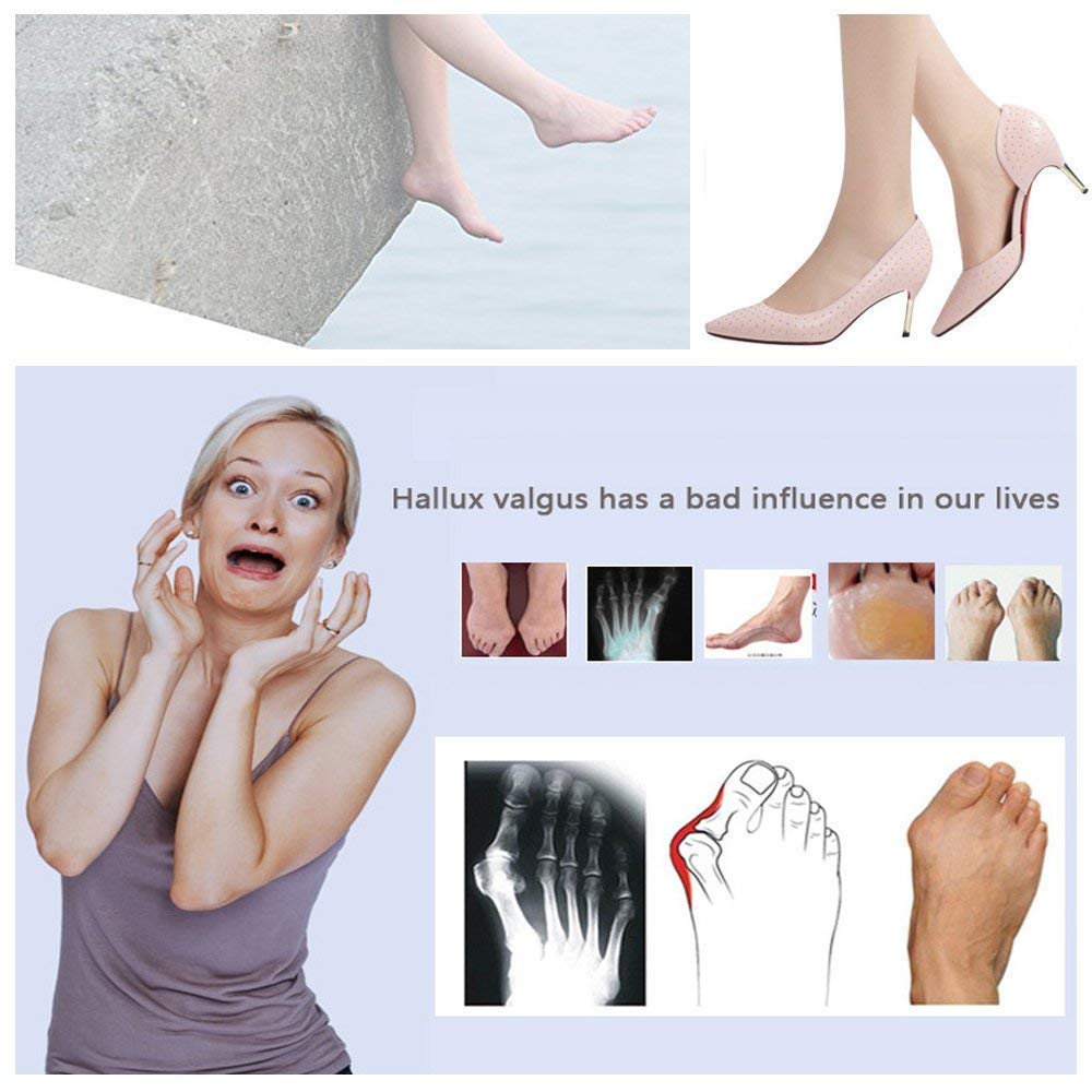 Askilt Bunion Corrector, Bunion Splints and Bunion Relief for Hallux Valgus, Big Toe Joint,Adjustable Bunion Splint Protector Sleeves kit F or Women and Men,7 pcs