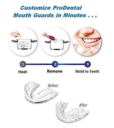 ProDental Thin and Trim Mouth Guard for Grinding Teeth – 3 Pack, Made in USA, Night Guard for Bruxism - Teeth Clenching, Use as Customizable Teeth Whitening Tray