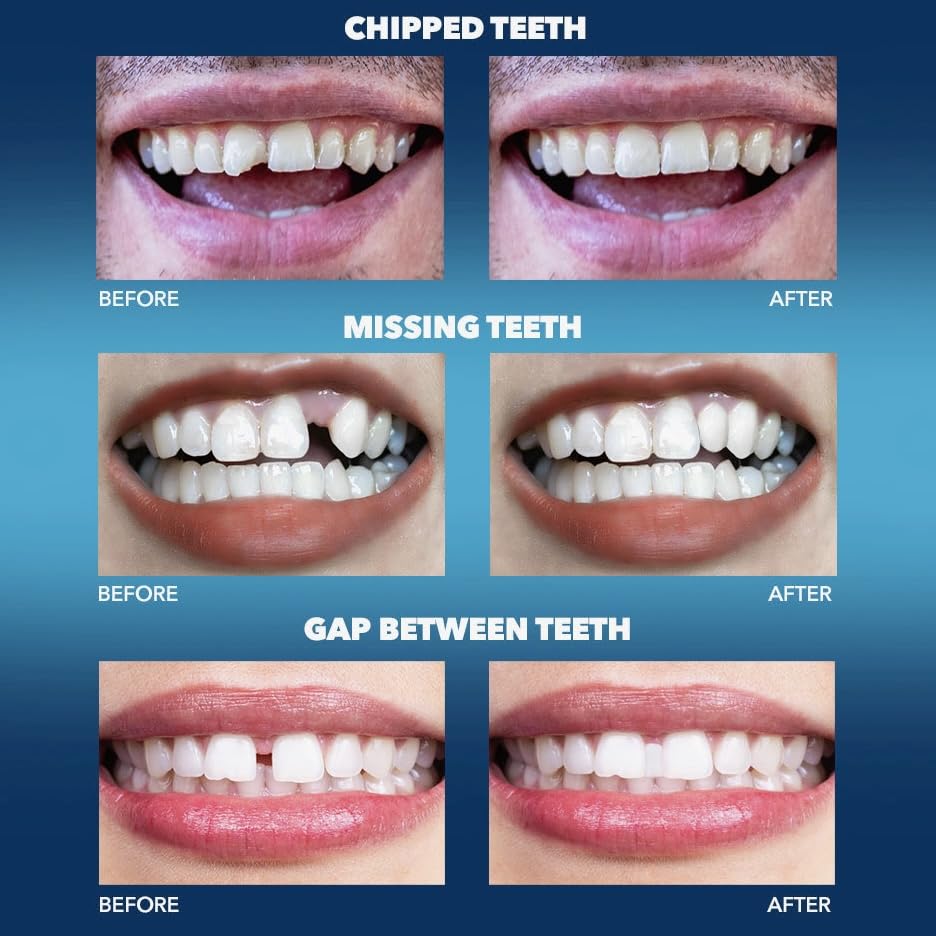 Imako Tooth Tinted Plastic - Natural Color - Temporary Tooth - Made in USA