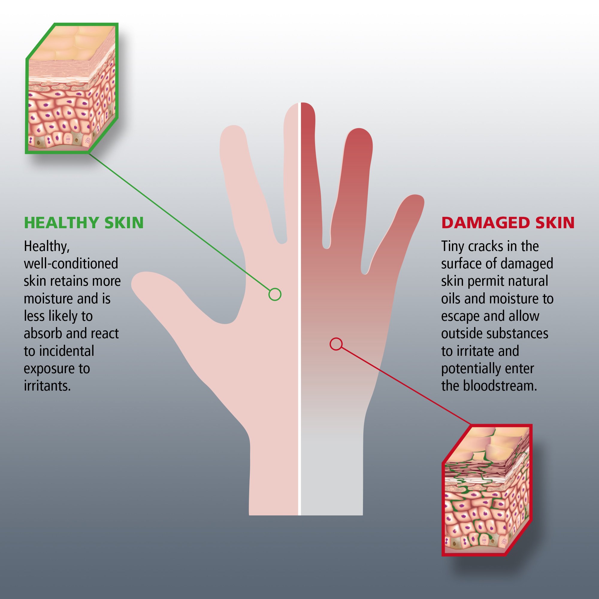 GOJO HAND MEDIC Professional Skin Conditioner, Fragrance Free, 2 fl oz Travel Size Squeeze Bottle (Pack of 12) - 8142-12