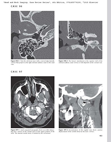 Head and Neck Imaging: Case Review Series