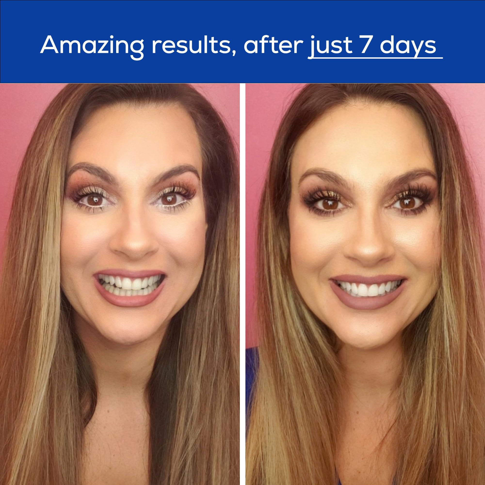 GLO Science Brilliant Teeth Whitening Gel Treatment Refill Vials, Mint Flavored, Clinically Proven to be Sensitivity & Pain-Free and Give Long Lasting Results | 3 Count (12 applications)