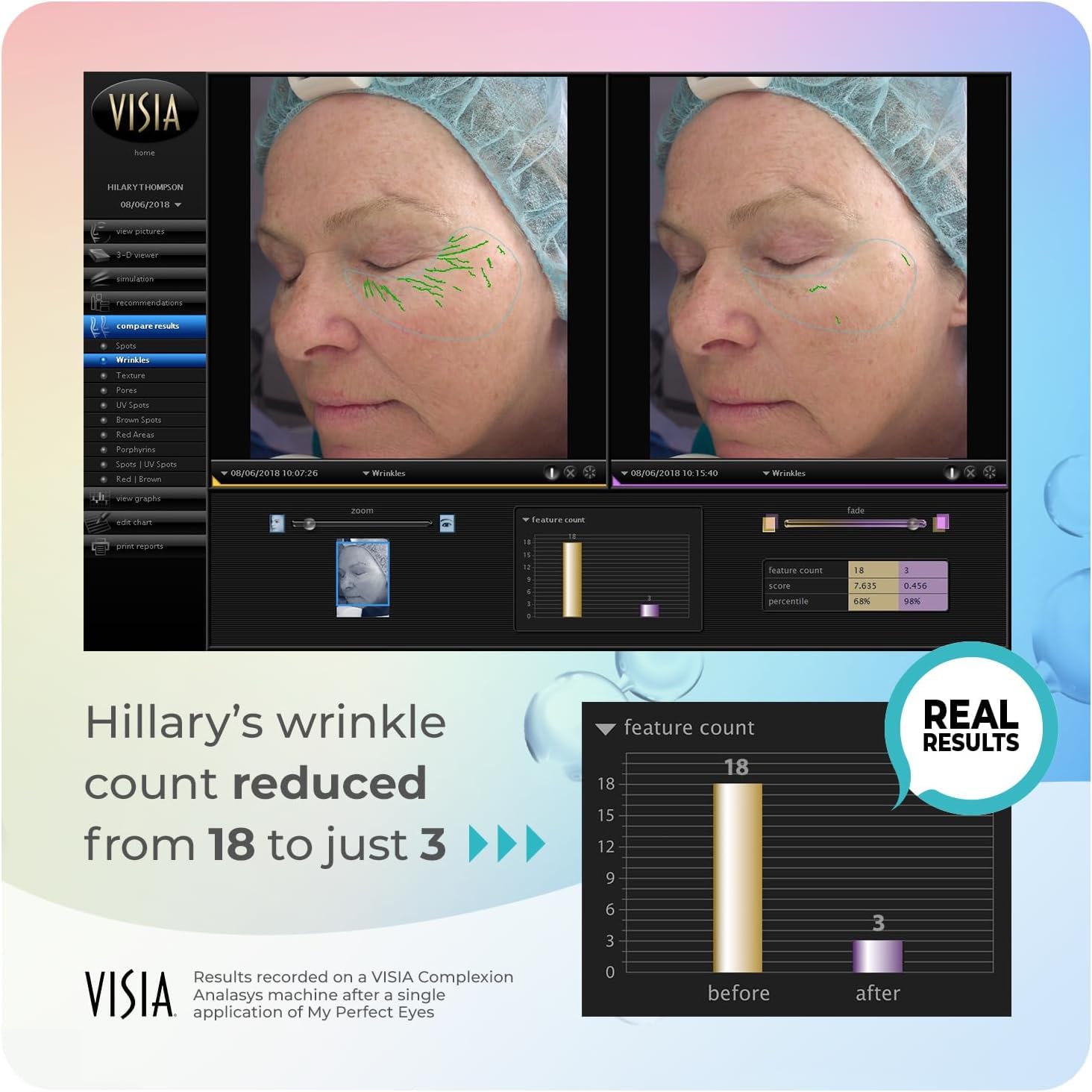 My Perfect Eyes 10ml, 100 Applications, Penny Lane, Instant Results, Clinically Proven, Anti-Ageing Serum UK Original Formula, Science-Backed Anti-Wrinkle Serum. As Seen on TV.