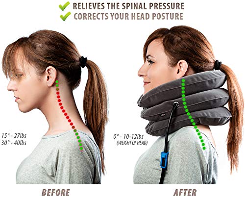 Pinched Nerve Neck Stretcher Cervical Traction Device for Home Pain Treatment | Inflatable Spinal Decompression Collar Unit Muscle Strain Injury Relief | Herniated Disc Problems Remedy Kit (Gray)