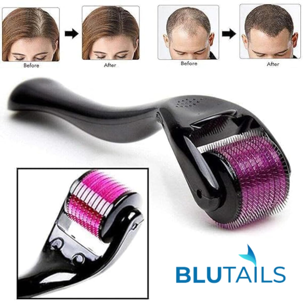 RadBizz Derma Roller and Storage Case - 0.25mm