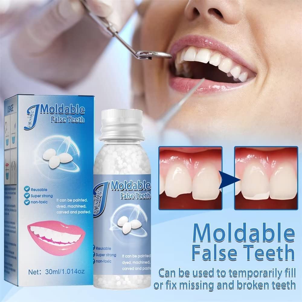 Aioweika Moldable Dental Care Glue for Filling Missing, Broken Teeth, Crowns and Bridges Temporary Teeth Replacement DIY Heat Fit Beads