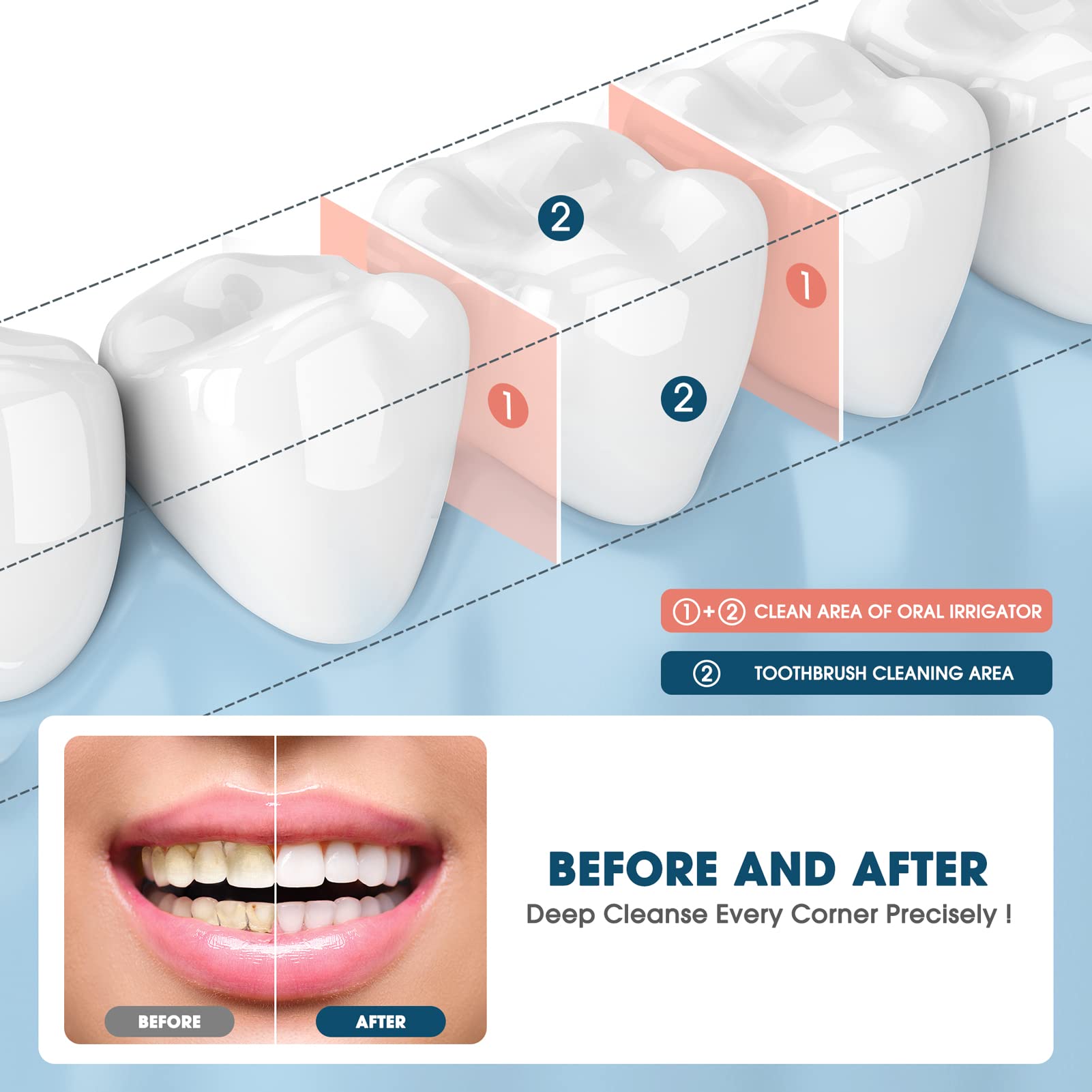 AROVEA Water Flosser, 5 Professional Modes, 8 Replaceable Jet Tips - IPX7 Waterproof, Powerful Rechargeable Battery Life, Oral Dental flosser for Home Travel
