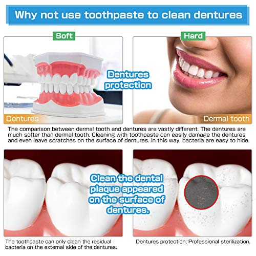 Ultrasonic Denture Cleaner, BlumWay Profession Retainer/Aligner/Mouth Guard Cleaner Machine, SUS304 Material 5 Minute Quick Cleaning