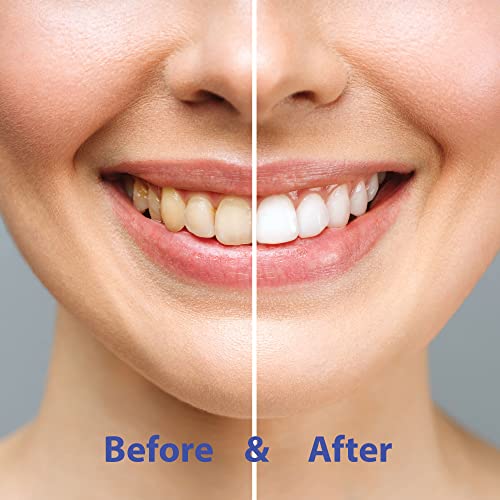 Chomp Super Whitening Toothpaste Tablets with Nano Hydroxyapatite